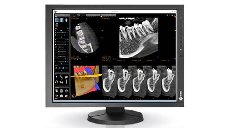 Màn hình Eizo RadiForce 21.3 inch RX350